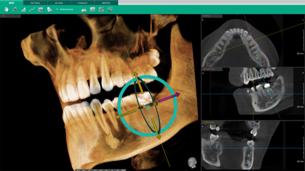 Dental Imaging – Wonderful Smile